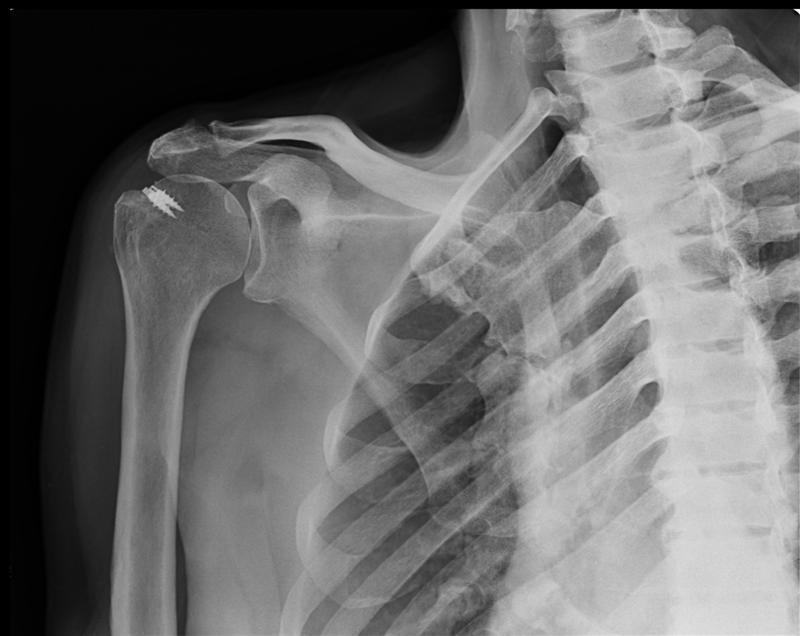 ΓΕΡΟΥΚΗΣ ΗΛΙΑΣ - ΑΚΤΙΝΟΛΟΓΟΣ ΠΑΛΑΙΟ ΦΑΛΗΡΟ ΑΤΤΙΚΗ - ΑΚΤΙΝΟΔΙΑΓΝΩΣΤΗΣ ...