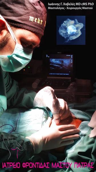 Chaveles Ioannis - Breast Care Clinic Patra - Mastologist Patra ...